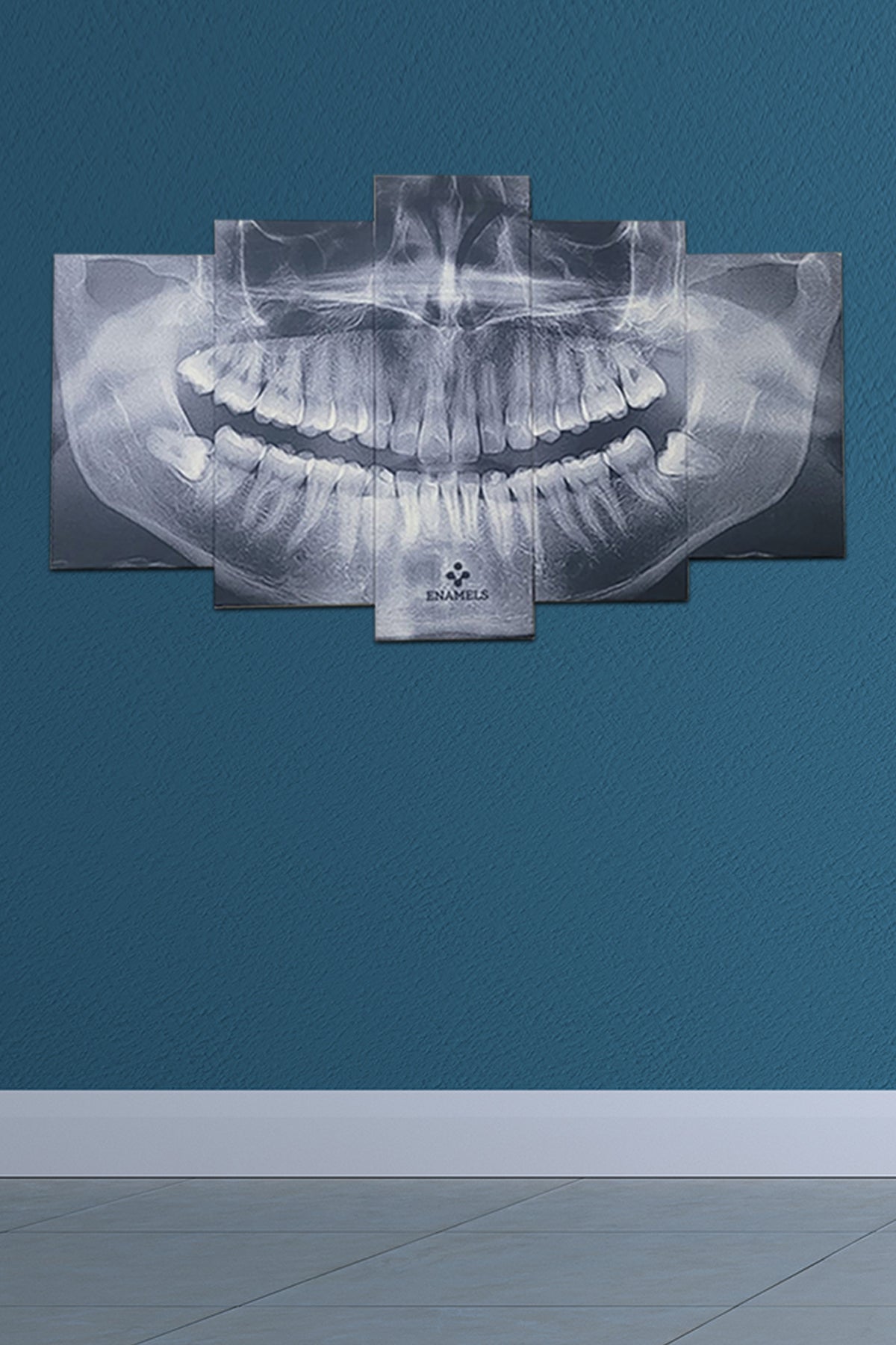 Large-5 Pcs Split Art-OPG-Free Delivery in Lahore | Large – enamels-online